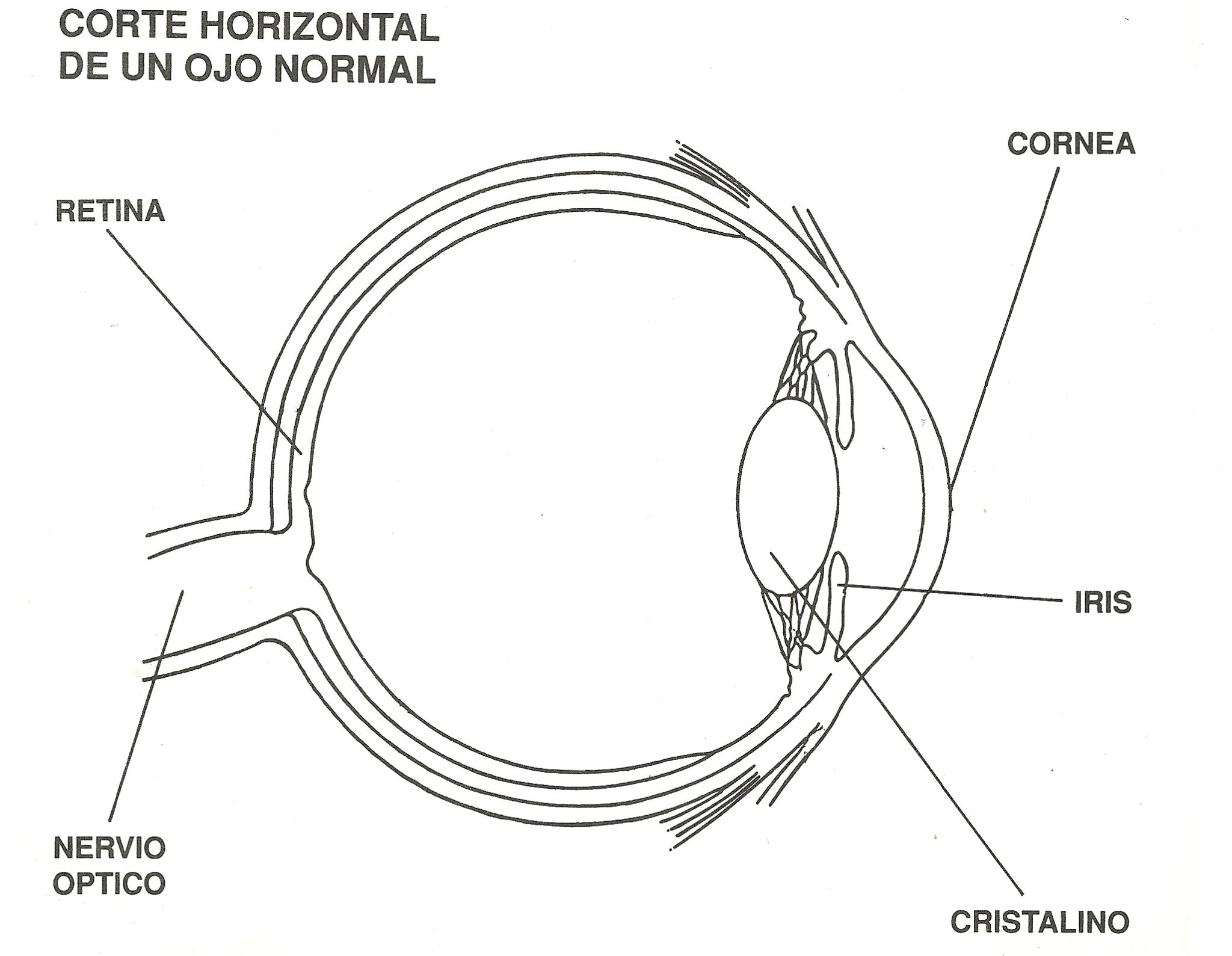 ¿Qué Es La Hipermetropía? 7 Aspectos Clave Para Entenderla